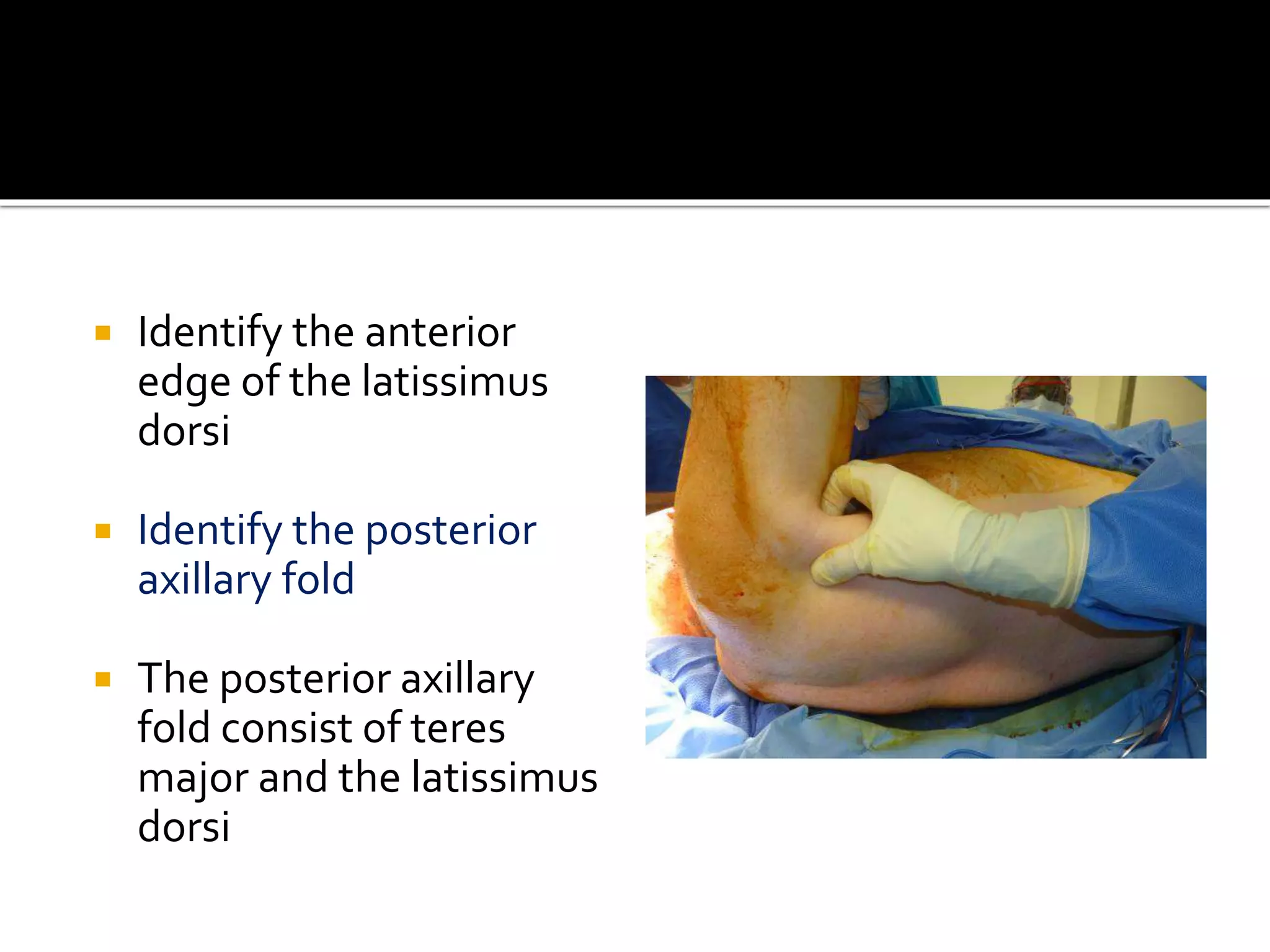 Free LD flap for scalp reconstruction DR VIPIN V NAIR | PPTX | Death, Injury, or Military ...