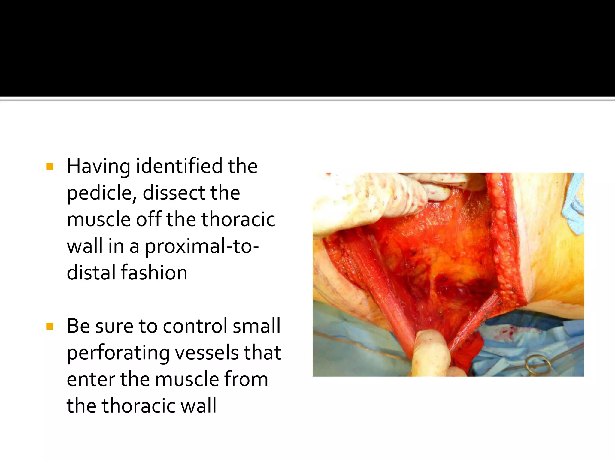 Free LD flap for scalp reconstruction DR VIPIN V NAIR | PPTX | Death ...