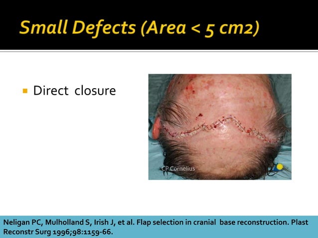 Free LD flap for scalp reconstruction DR VIPIN V NAIR | PPTX | Death ...