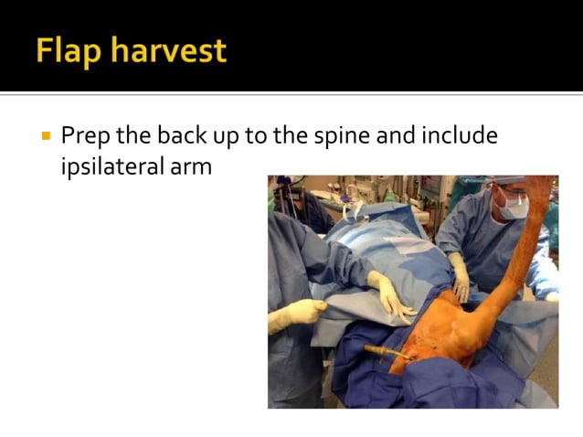 Free LD flap for scalp reconstruction DR VIPIN V NAIR | PPTX | Death ...