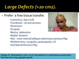 Free LD flap for scalp reconstruction DR VIPIN V NAIR | PPTX