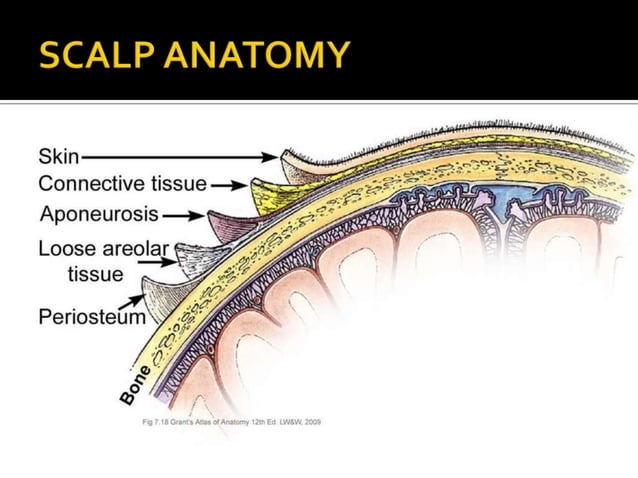Free LD flap for scalp reconstruction DR VIPIN V NAIR | PPTX | Death, Injury, or Military ...