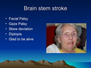 Freeman diplopia visual field defects | PPT