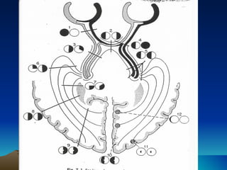 Defect Temporal Crescent