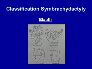 Free non vascularized toe phalangeal grafts | PPT