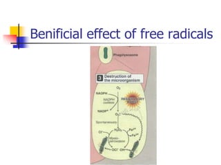 free radicals and antioxidant system.ppt