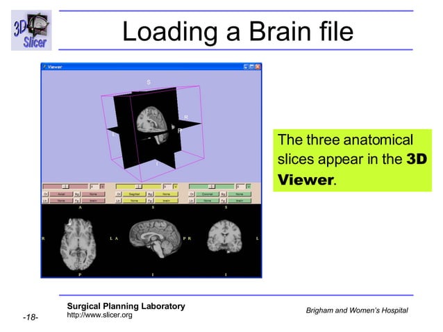 FreeSurfer Reader-3766 | PPT