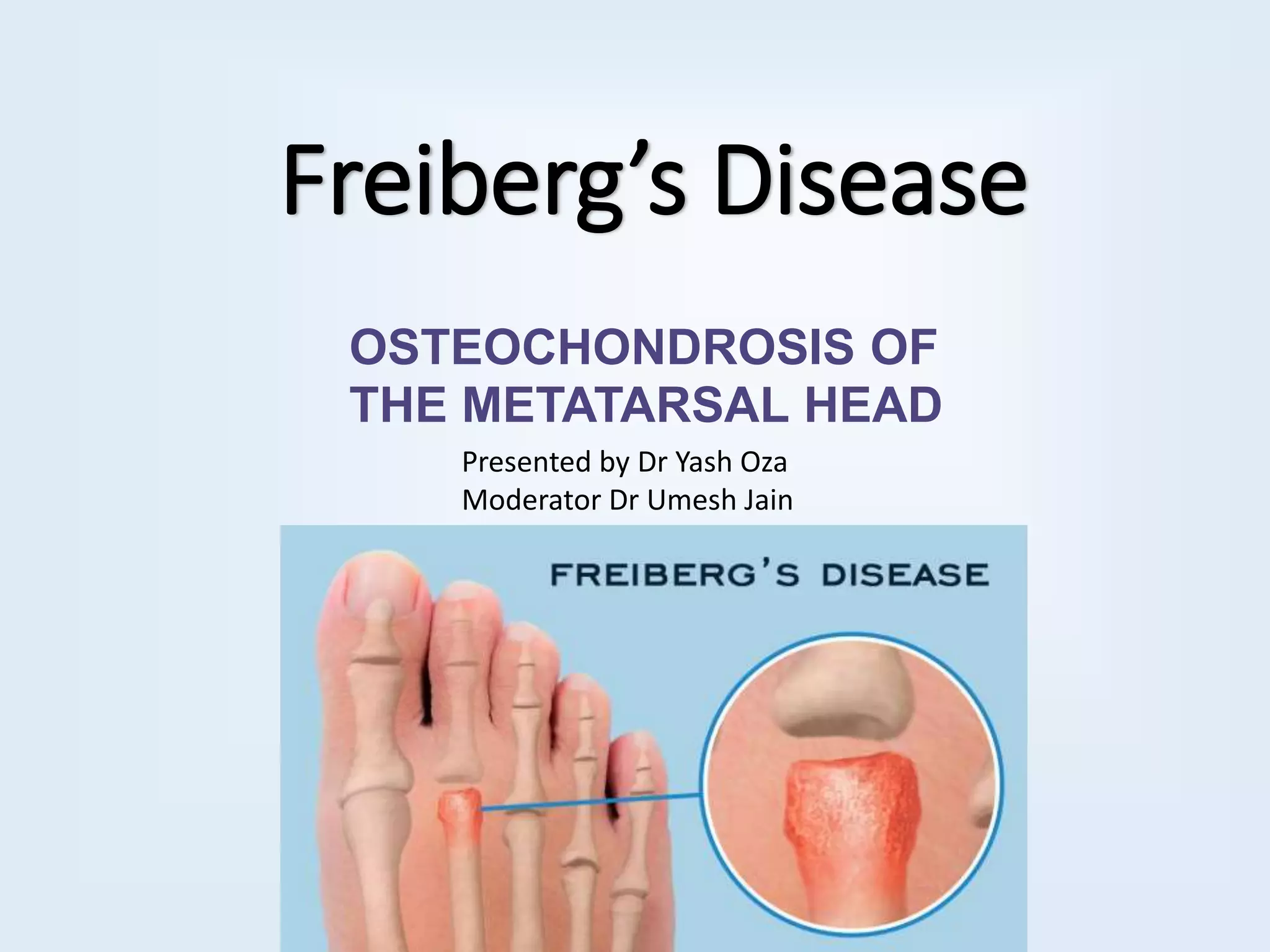 Freiberg's disease | PPTX