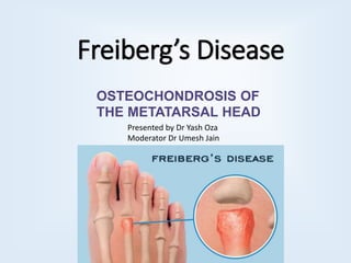 Freiberg's disease | PPTX