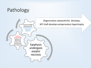 Freiberg's disease | PPTX