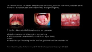 Frenillos Bucales | PPTX