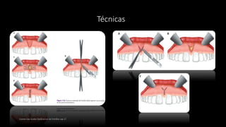 Frenillos Bucales | PPTX