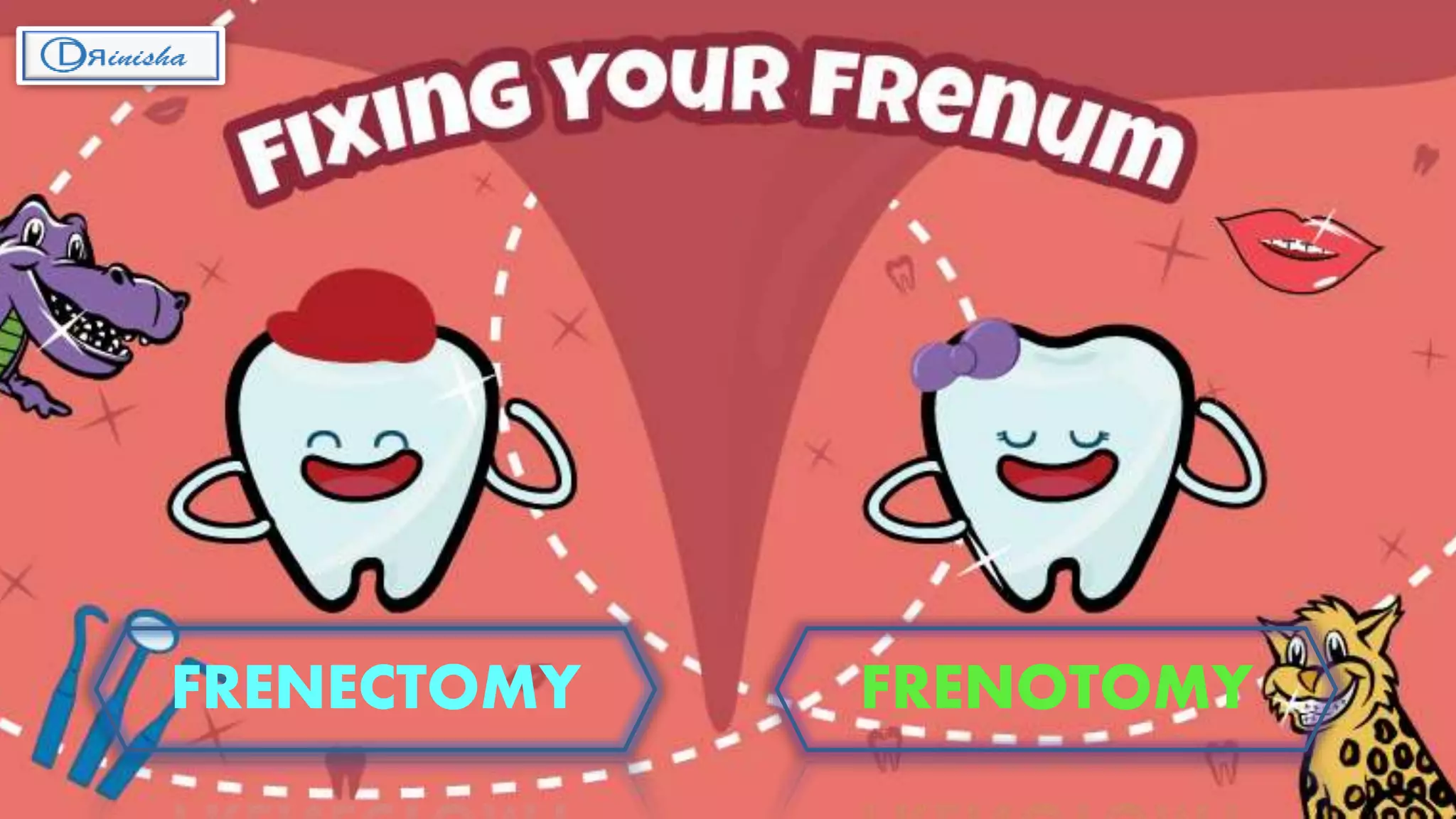 Frenectomy | PPTX