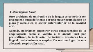 Frenillo lingual.pptx