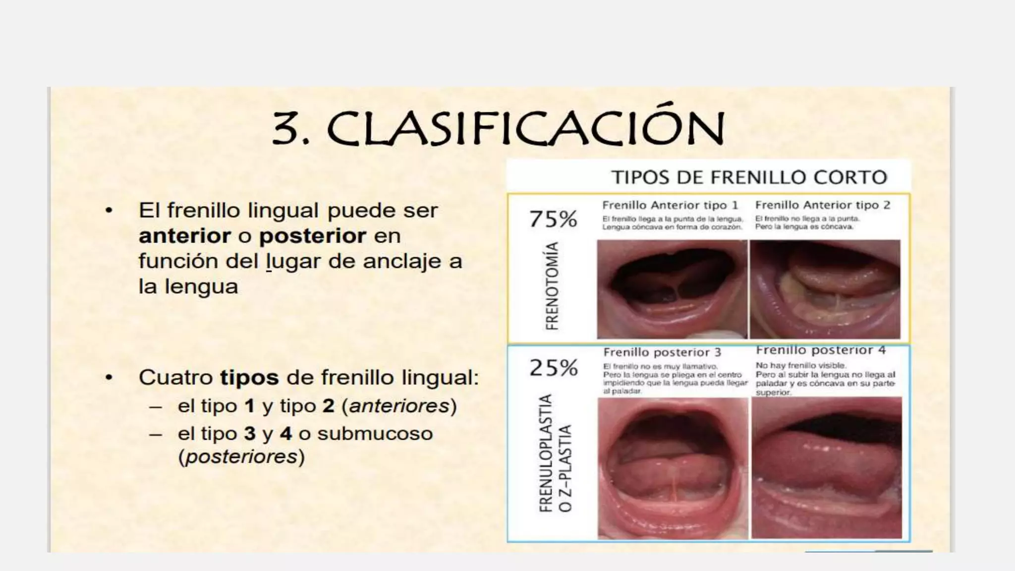 Frenillo lingual.pptx