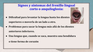 Frenillo lingual corto.pptx