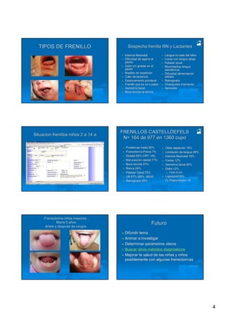 Frenillo lingual | PDF