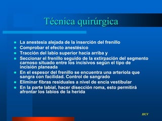 Frenillos - Frenectomia.cirugia basica y metodos | PPTX