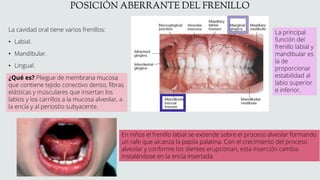 Frenillos y Vestibuloplastia.pptx