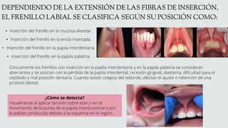 Frenillos y Vestibuloplastia.pptx