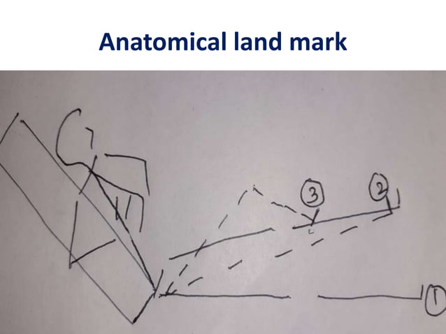 Frenkels exercise | PPTX