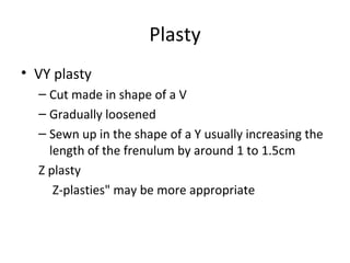 Frenuloplasty | PPT