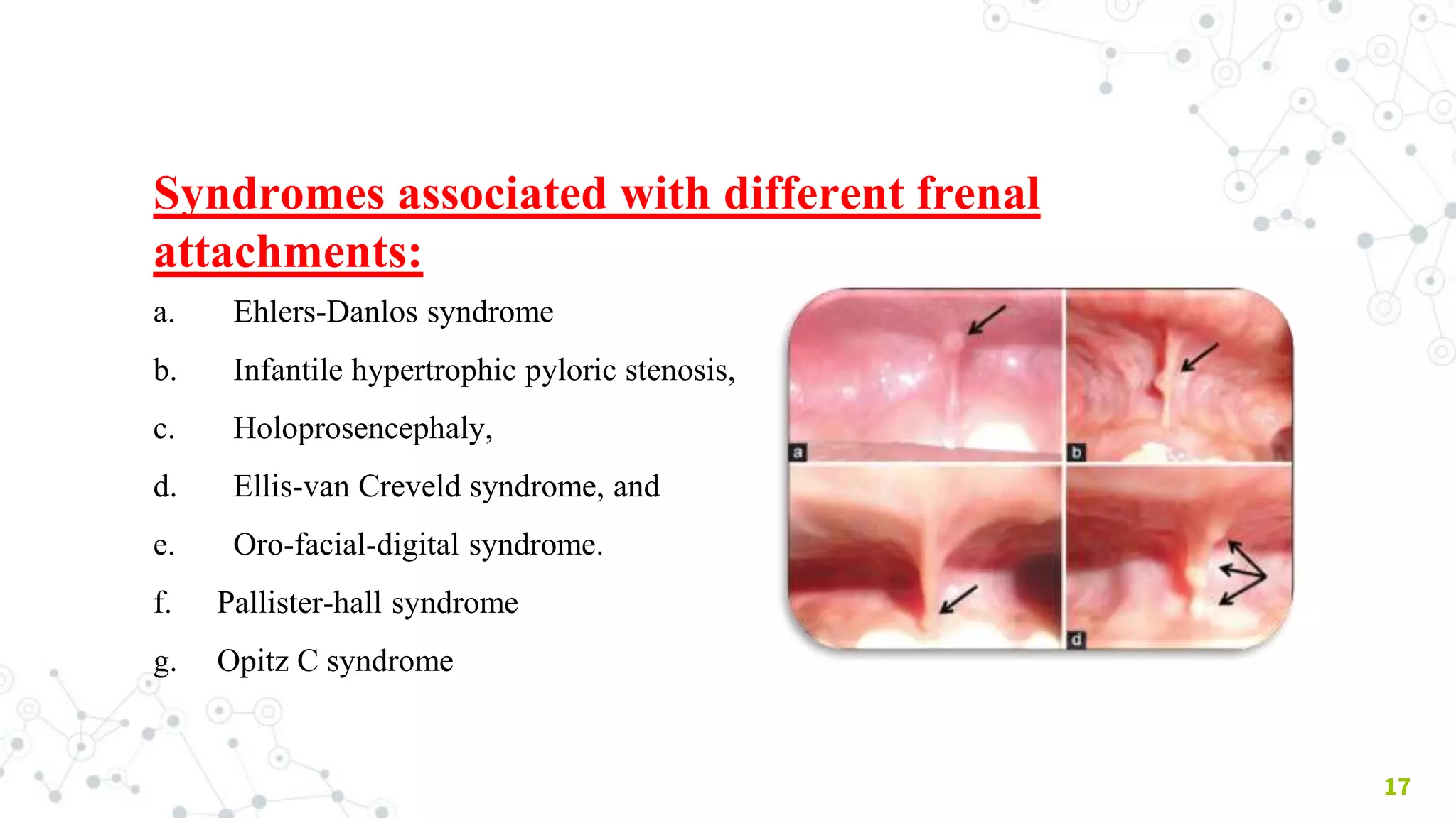 FRENAL ATTACHMENT & ITS MANAGEMENT | PPTX