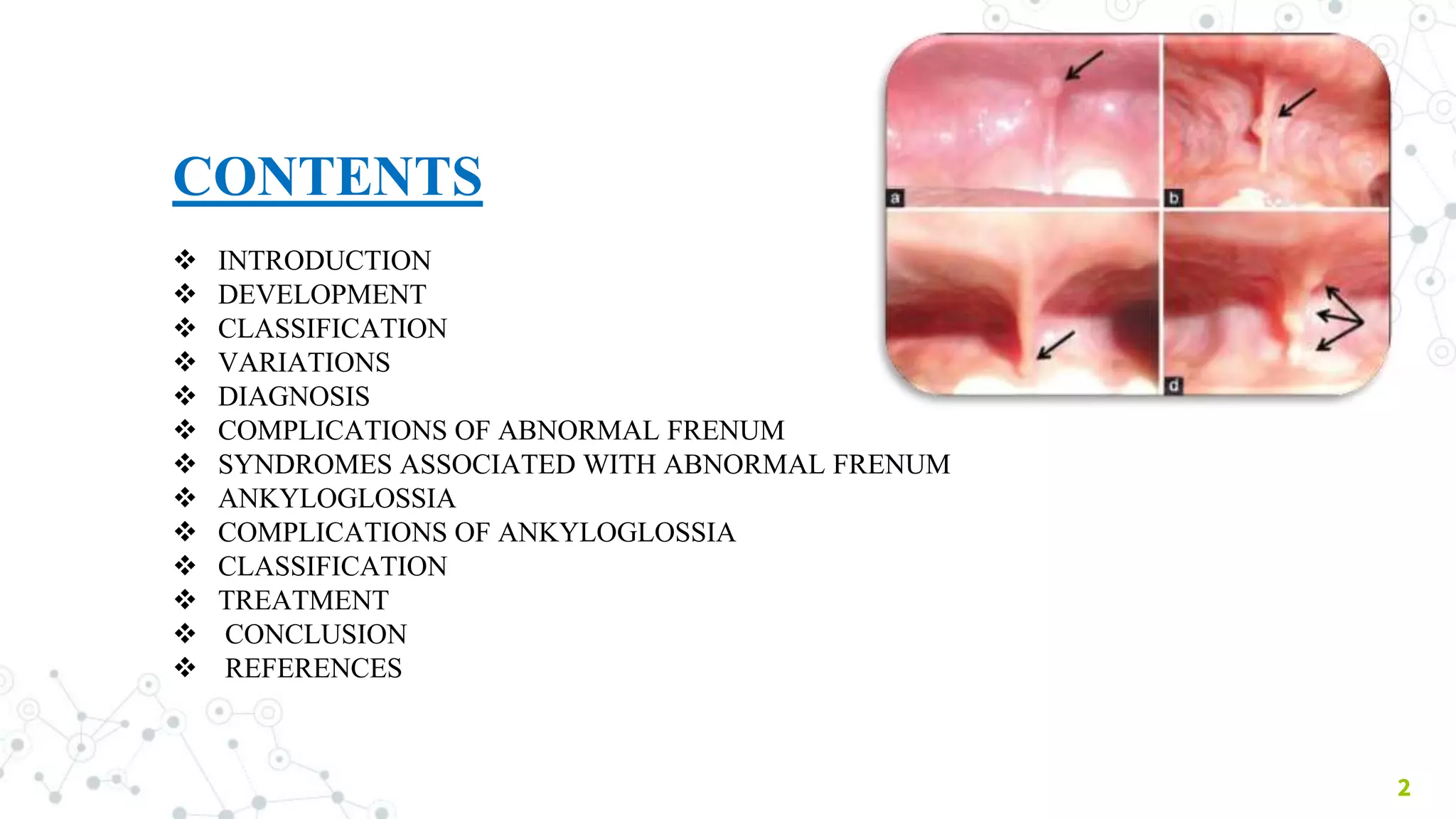 FRENAL ATTACHMENT & ITS MANAGEMENT | PPTX