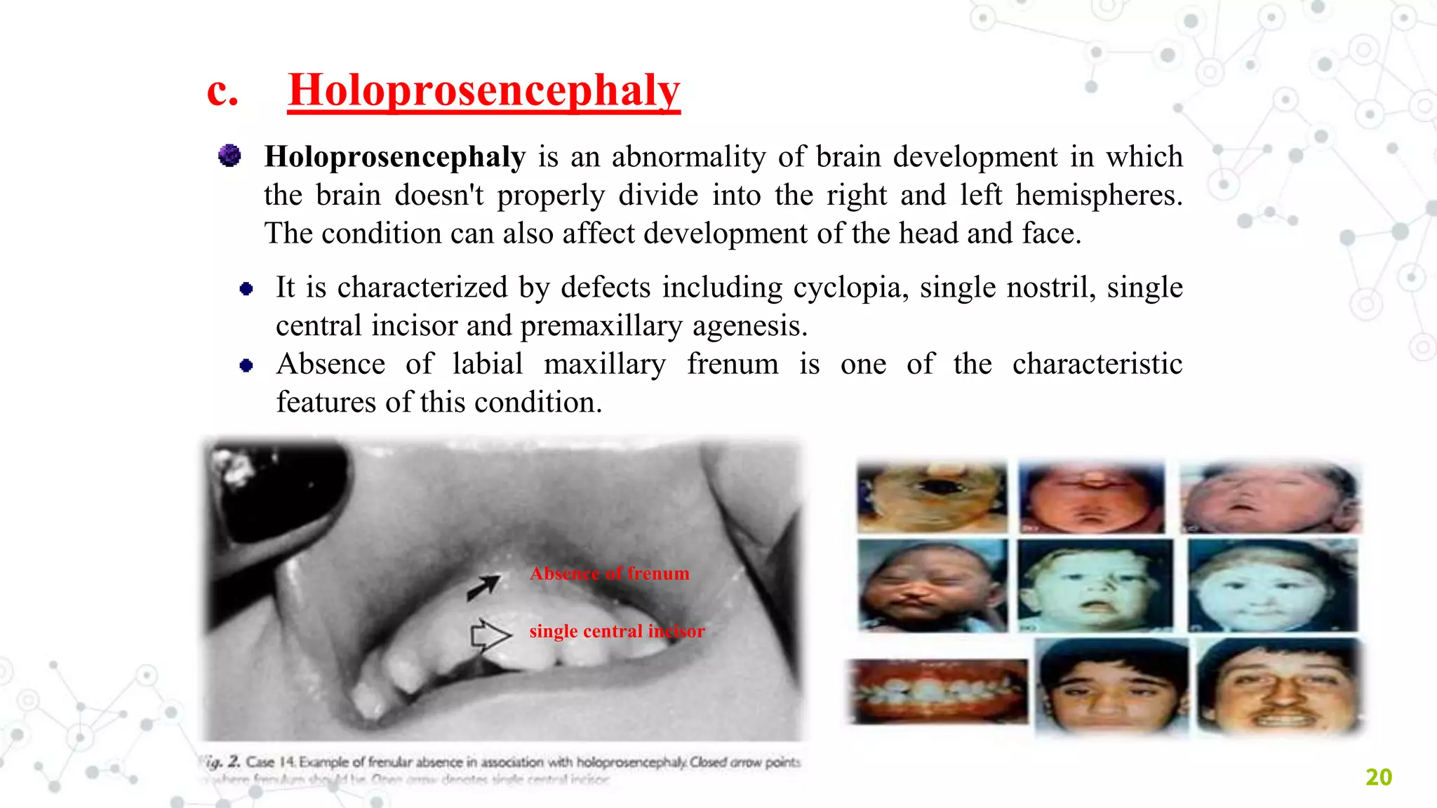 FRENAL ATTACHMENT & ITS MANAGEMENT | PPTX
