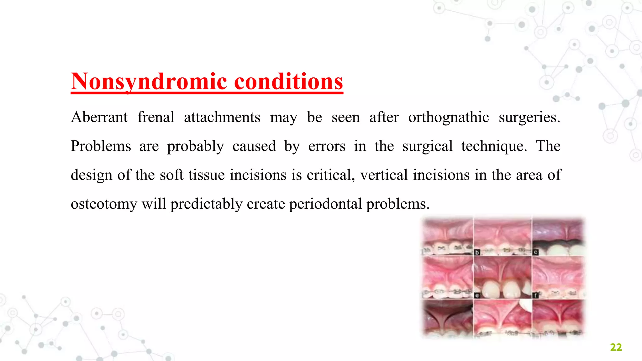 FRENAL ATTACHMENT & ITS MANAGEMENT | PPTX