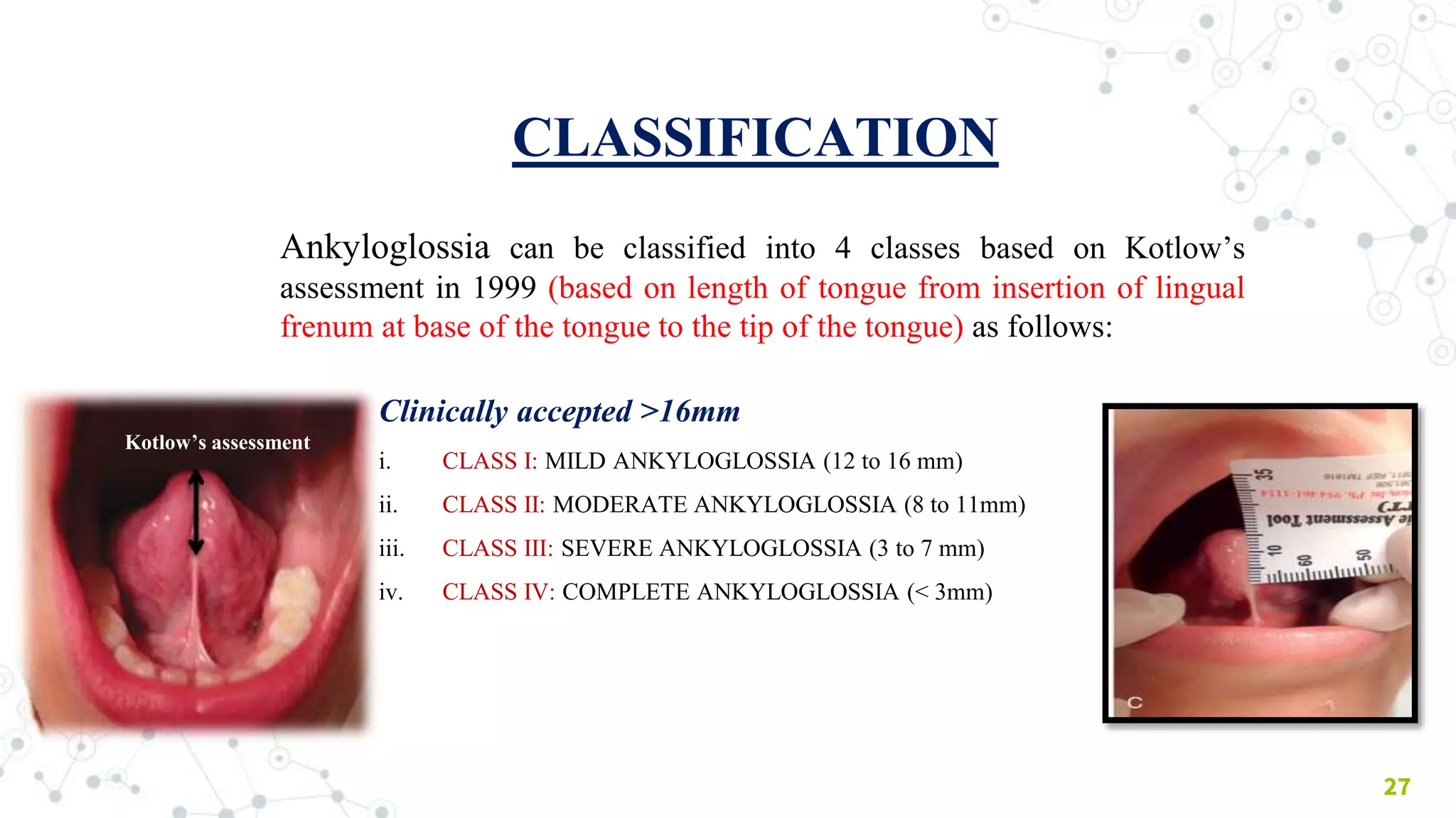 FRENAL ATTACHMENT & ITS MANAGEMENT | PPTX