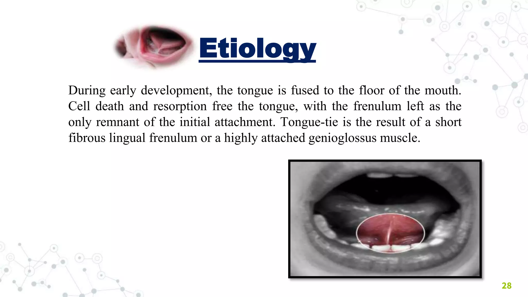 FRENAL ATTACHMENT & ITS MANAGEMENT | PPTX