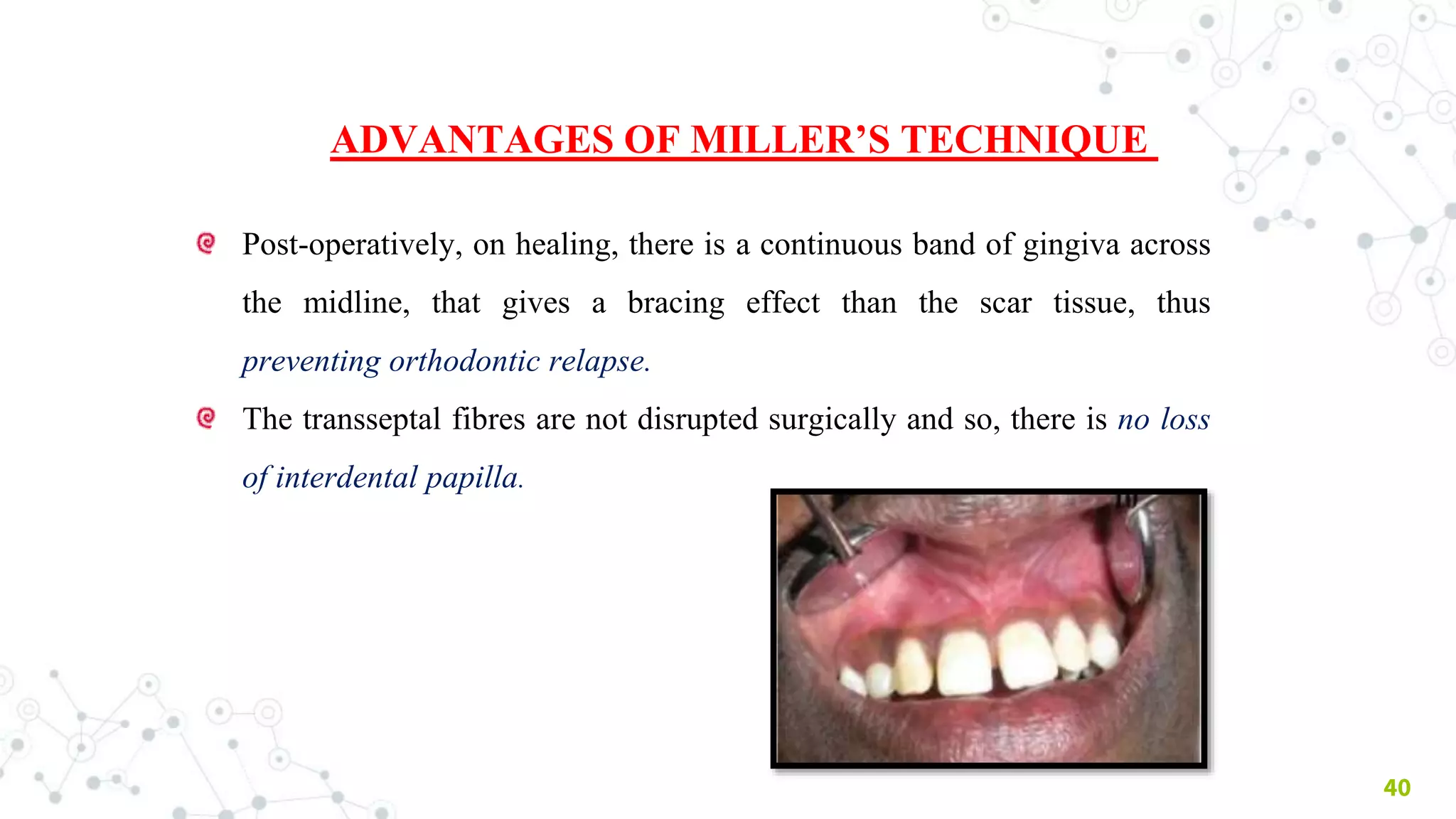 FRENAL ATTACHMENT & ITS MANAGEMENT | PPTX