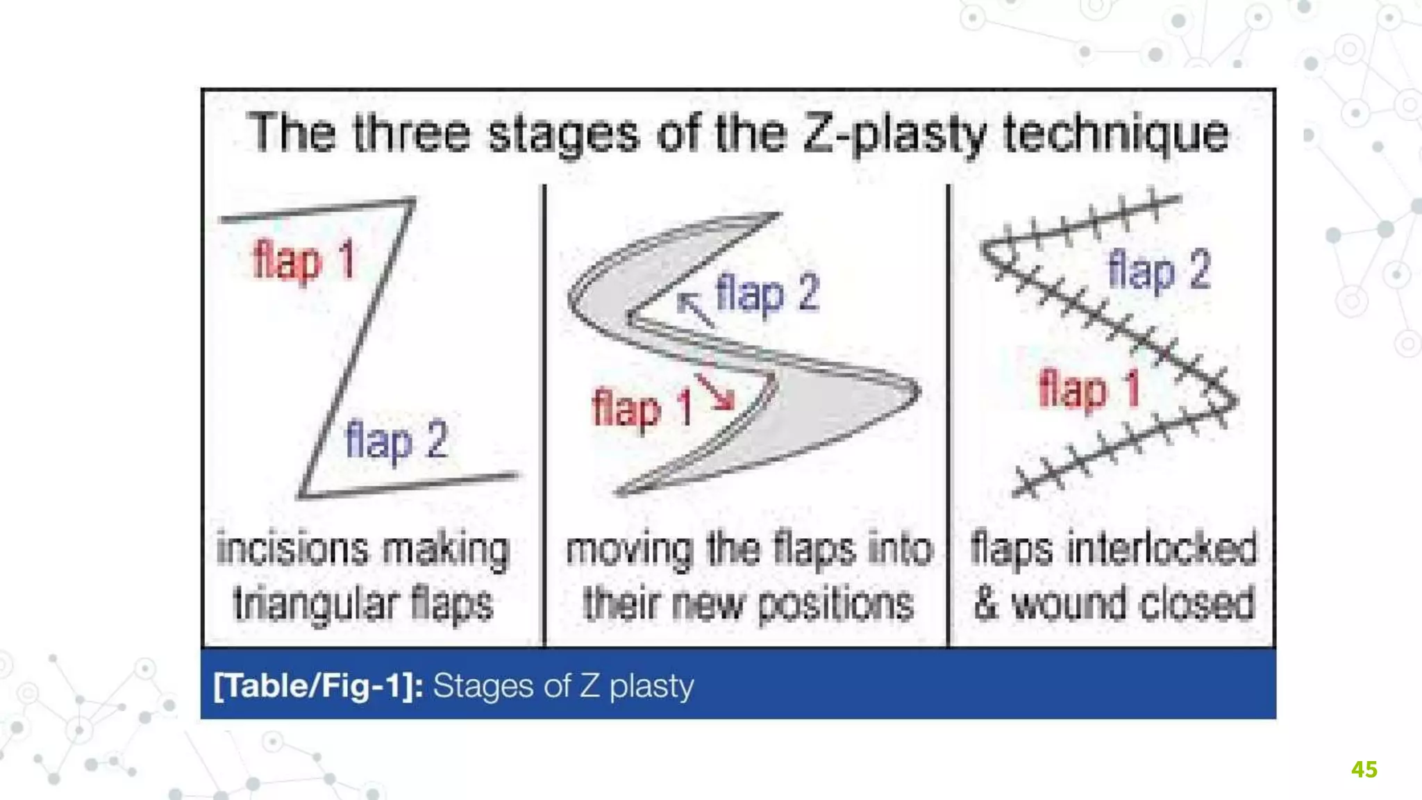 FRENAL ATTACHMENT & ITS MANAGEMENT | PPTX