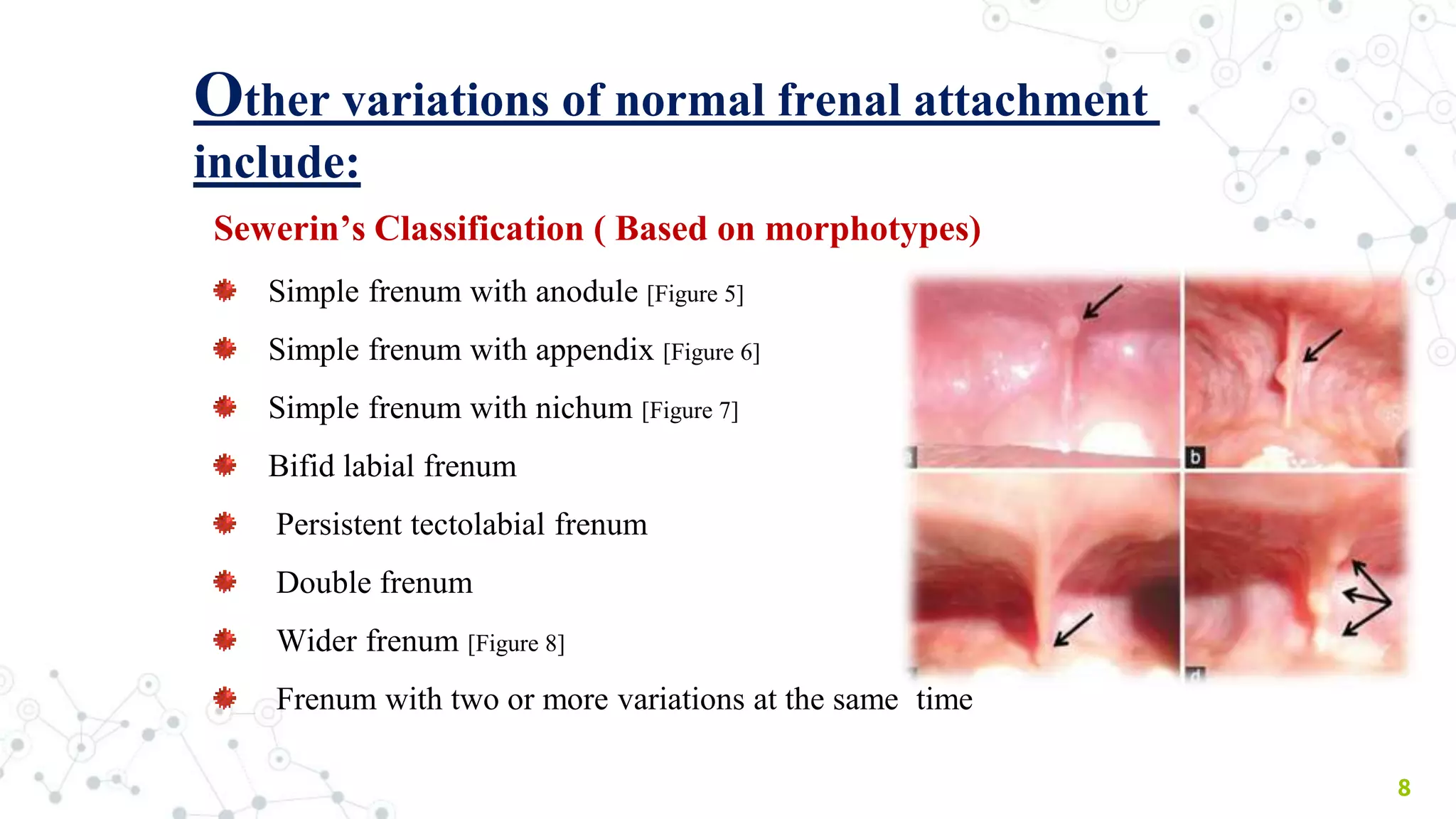 FRENAL ATTACHMENT & ITS MANAGEMENT | PPTX