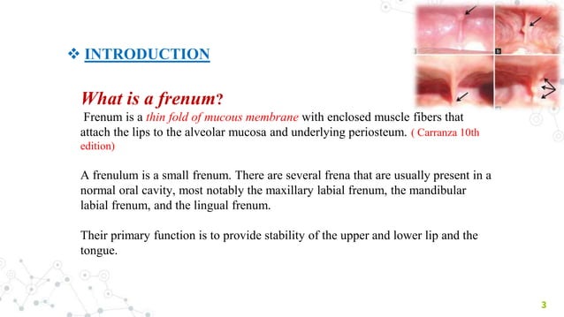 FRENAL ATTACHMENT & ITS MANAGEMENT | PPTX | Oral care | Personal Care