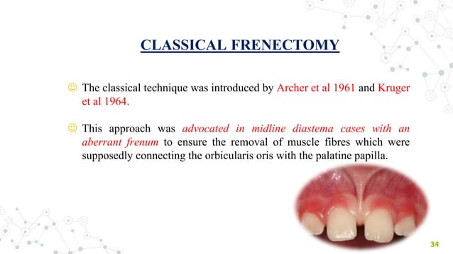 FRENAL ATTACHMENT & ITS MANAGEMENT | PPTX | Oral care | Personal Care