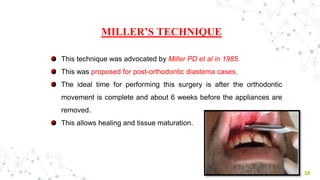 FRENAL ATTACHMENT & ITS MANAGEMENT | PPTX