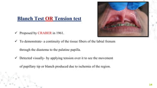 FRENAL ATTACHMENT & ITS MANAGEMENT | PPT