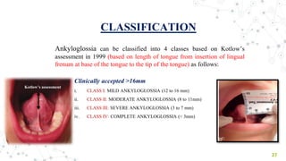 FRENAL ATTACHMENT & ITS MANAGEMENT | PPT