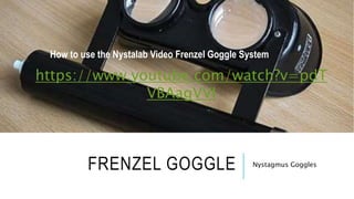 Frenzel Goggles nystagmus how to examine | PPTX