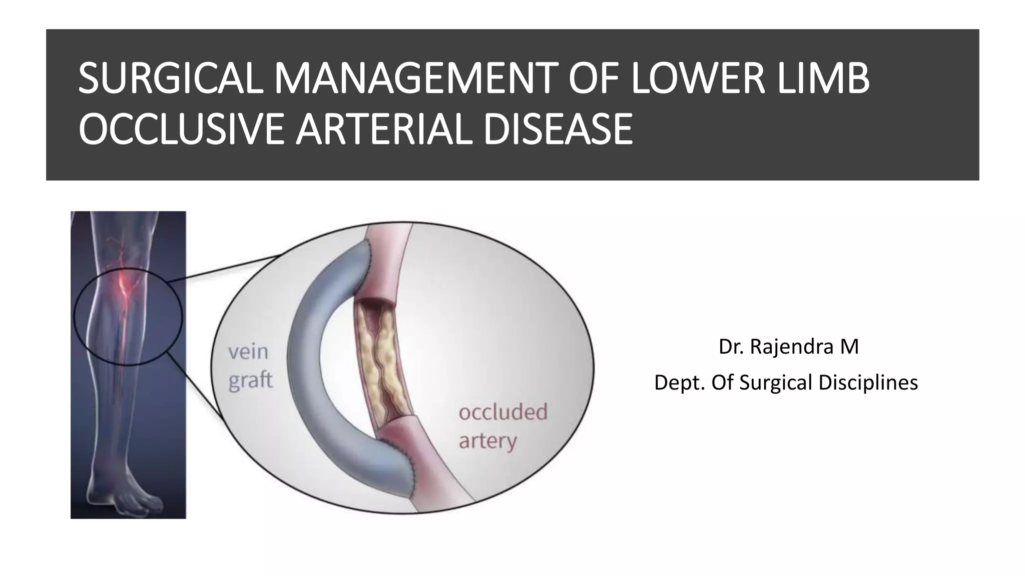 Surgical Management of Lower Limb Occlusive Arterial Disease | PPTX