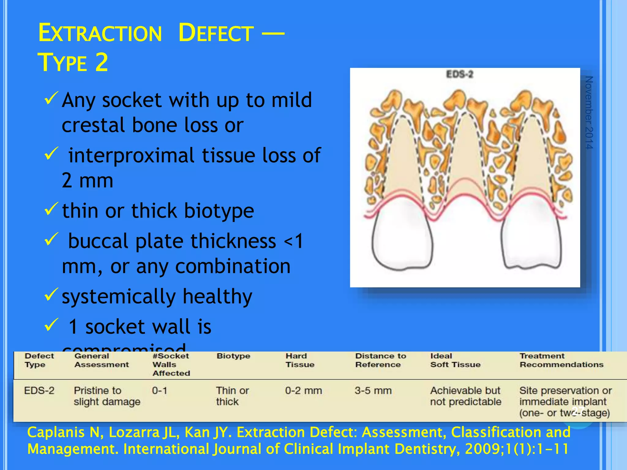 Fresh socket implant placement | PPTX