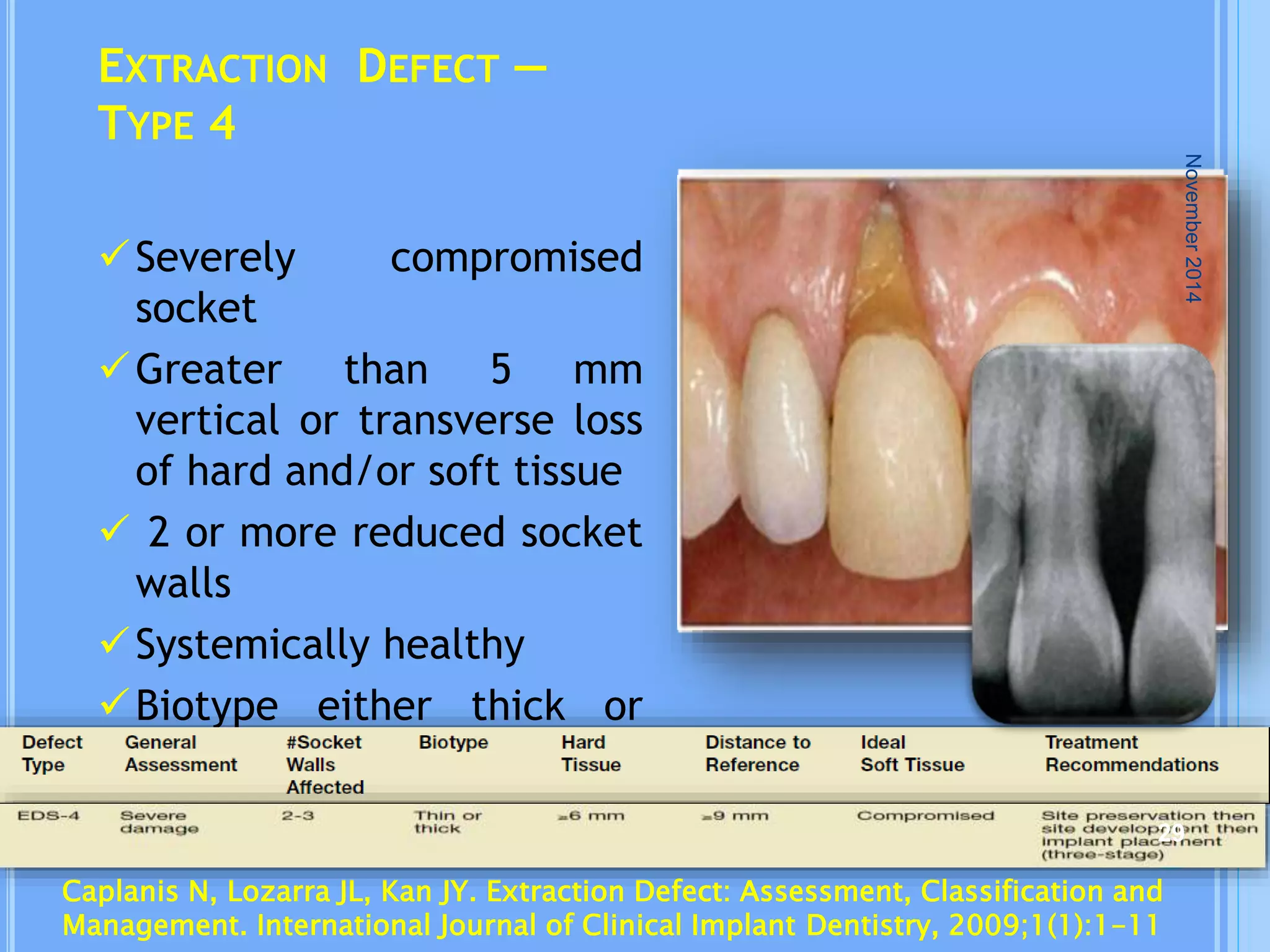 Fresh socket implant placement | PPTX