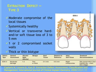 Fresh socket implant placement | PPT