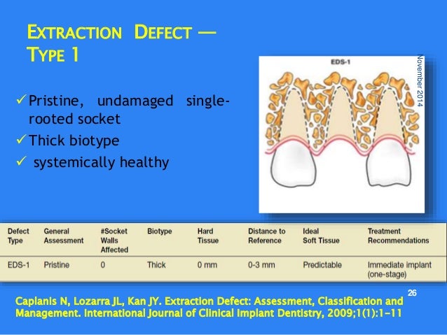 Fresh socket implant placement