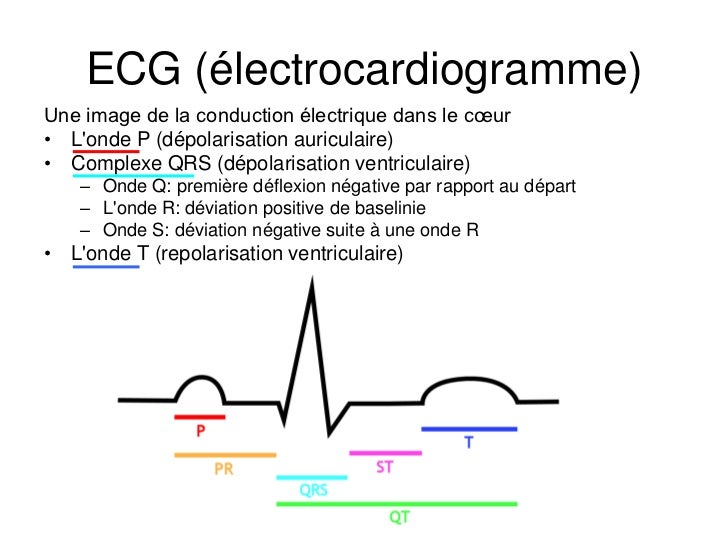 Base ECG et l'interprétation du rythme (French) Symposia