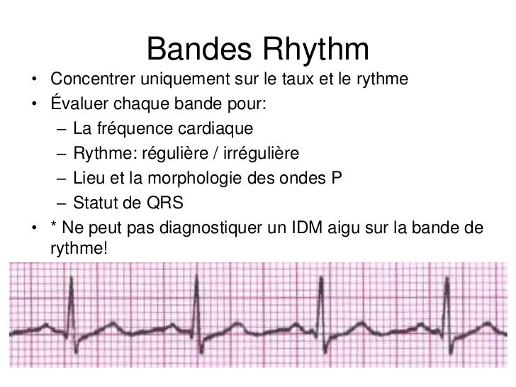 Leads Ecg In French at Amanda Barbour blog