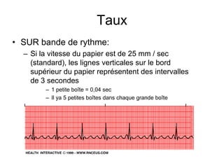 Basic EKG and Rhythm Interpretation Symposia | PPT