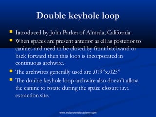 Friction less mechanics in orthodontics /certified fixed orthodontic ...